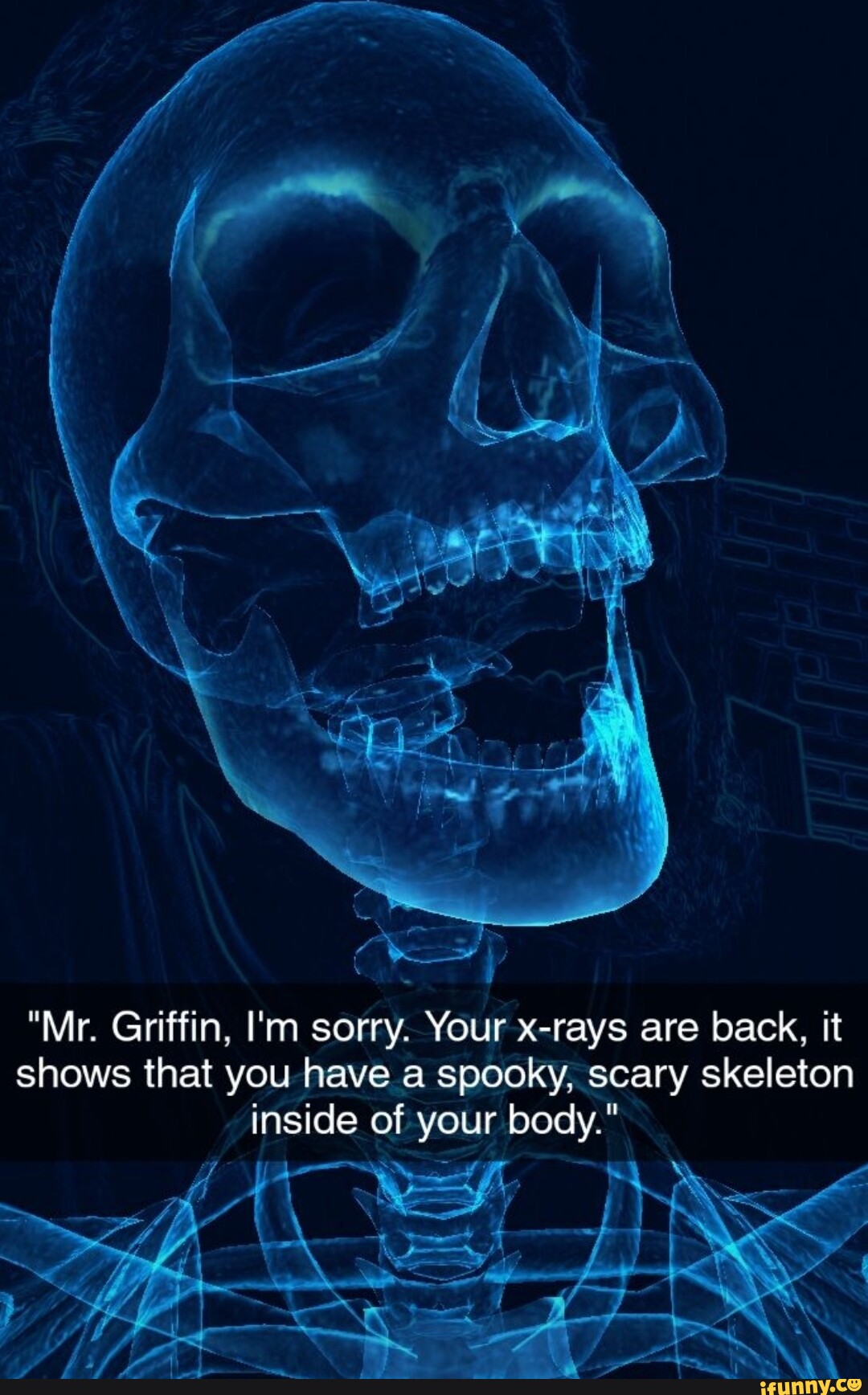 "Mr. Griffin, I'm sorry. Your x-rays are back, it shows that you have a ...