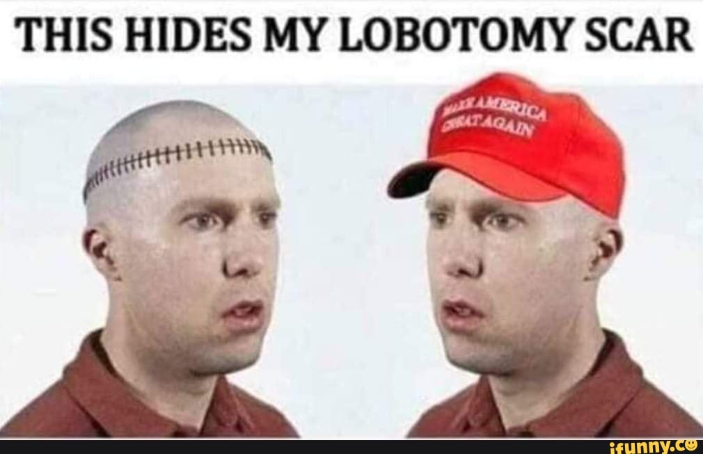 THIS HIDES MY LOBOTOMY SCAR - iFunny