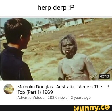 Herp Derp Meme