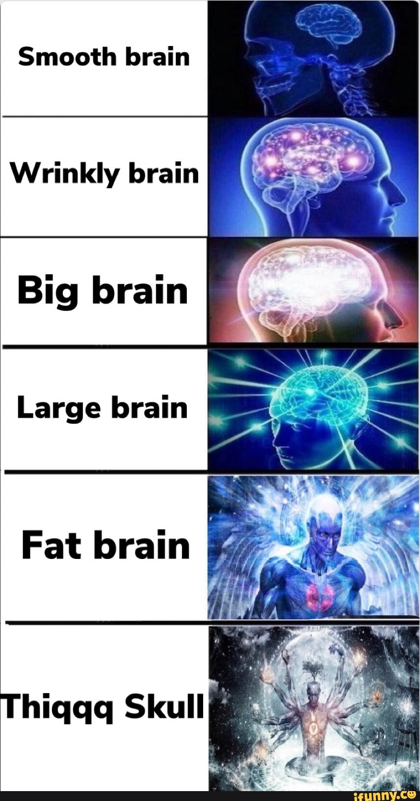 Smooth brain Wrinkly brain Big brain Large brain Fat brain Thiqqgq ...