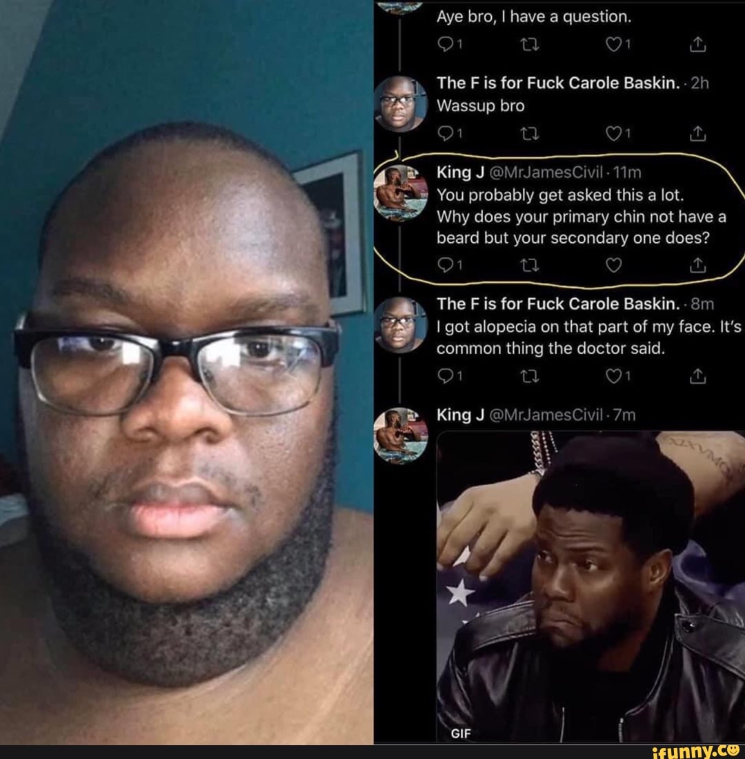 Recognizing Hand Scars 'Chef 'Auto Mechanic Viking Barbarian Dragon ...