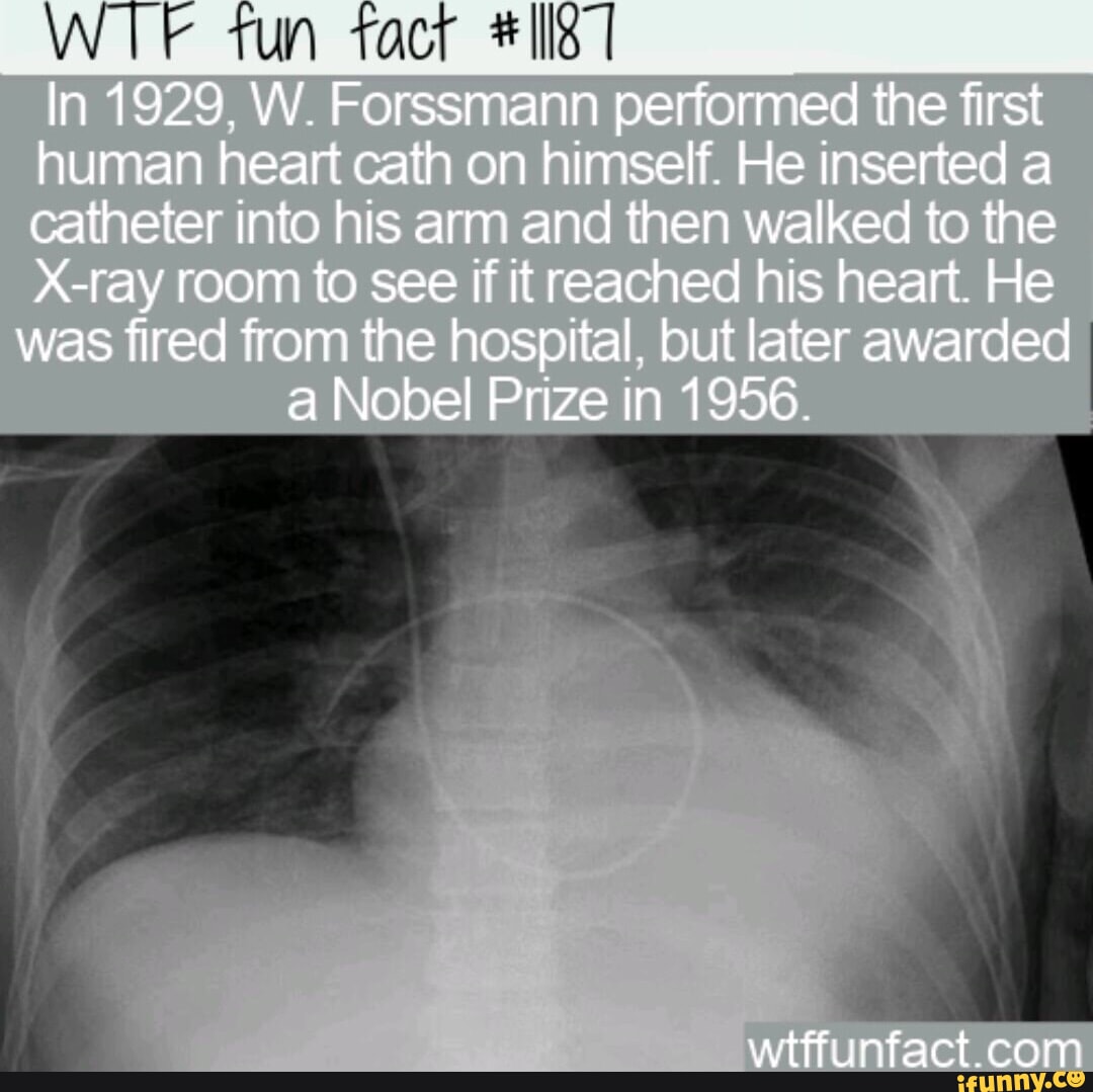 Catheter memes. Best Collection of funny Catheter pictures on iFunny