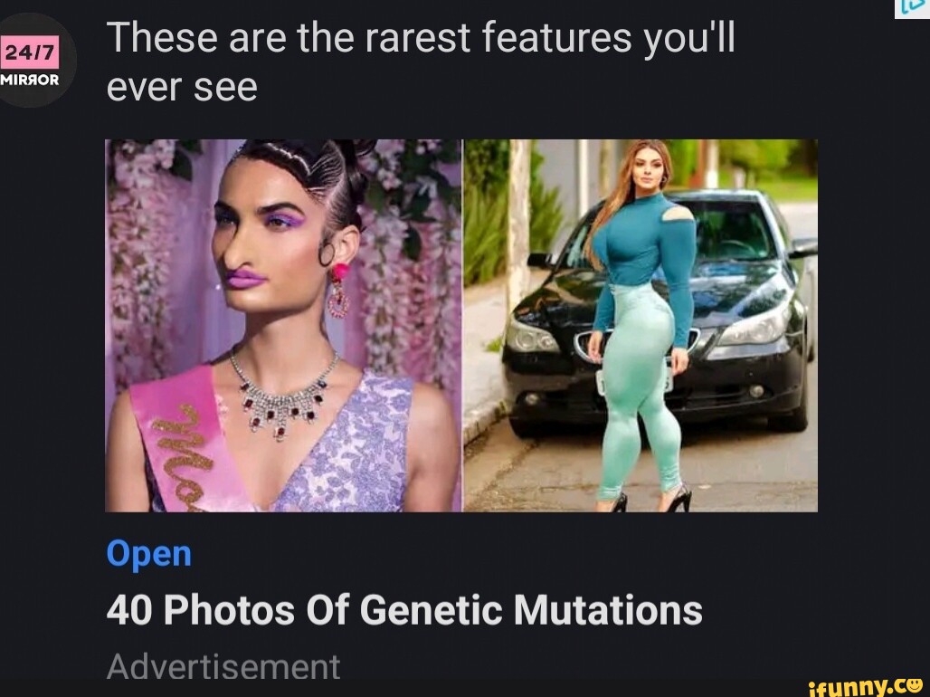 These are the rarest features you'll ever see Open 40 Photos Of Genetic ...