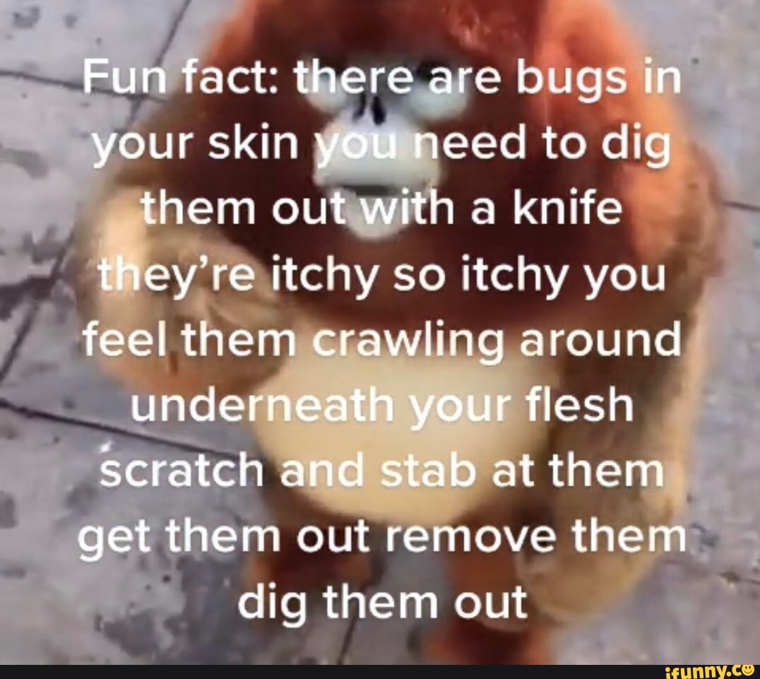 Fun fact: there are bugs in your skin you need to dig them out with a ...