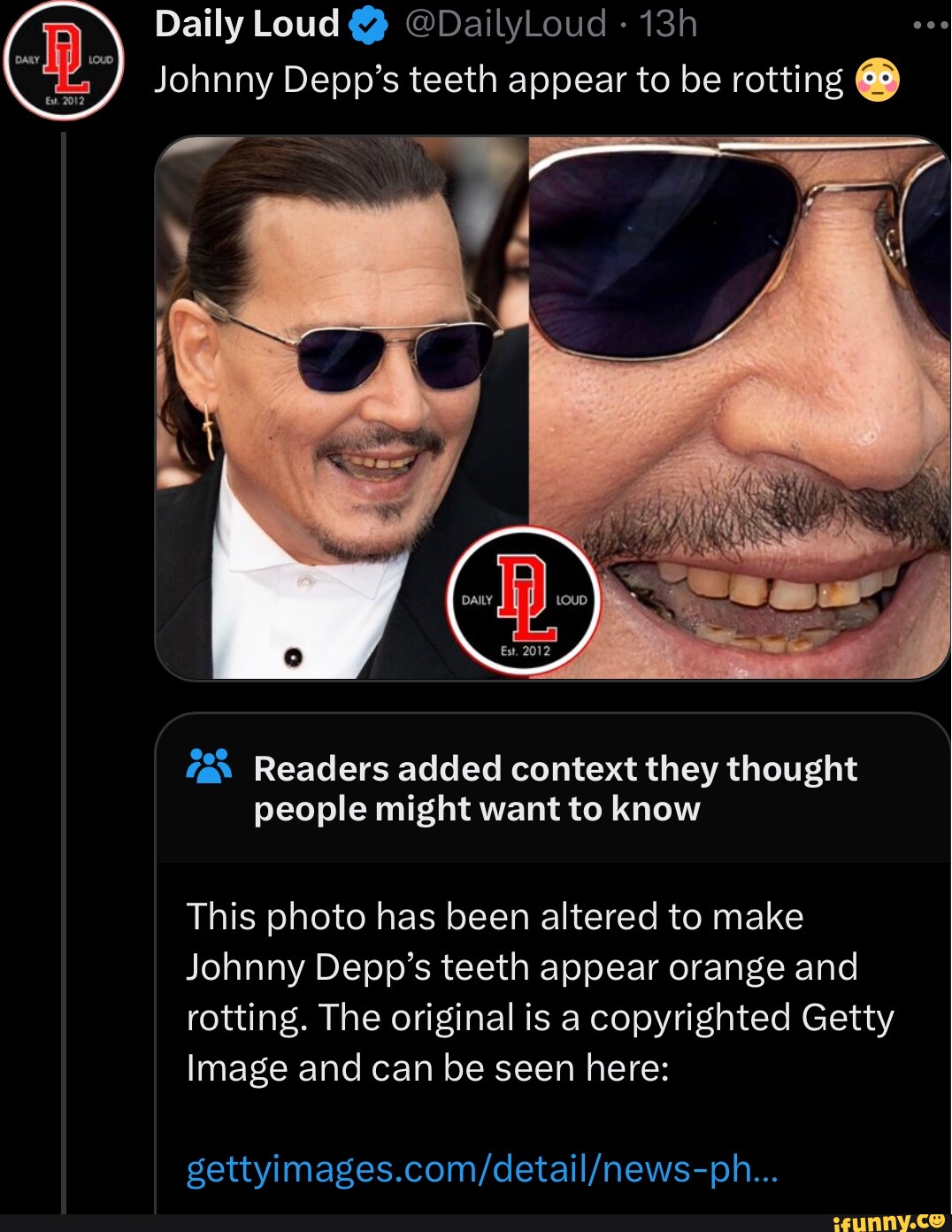 Daily Loud @ @DailyLoud Johnny Depp's teeth appear to be rotting fa ...