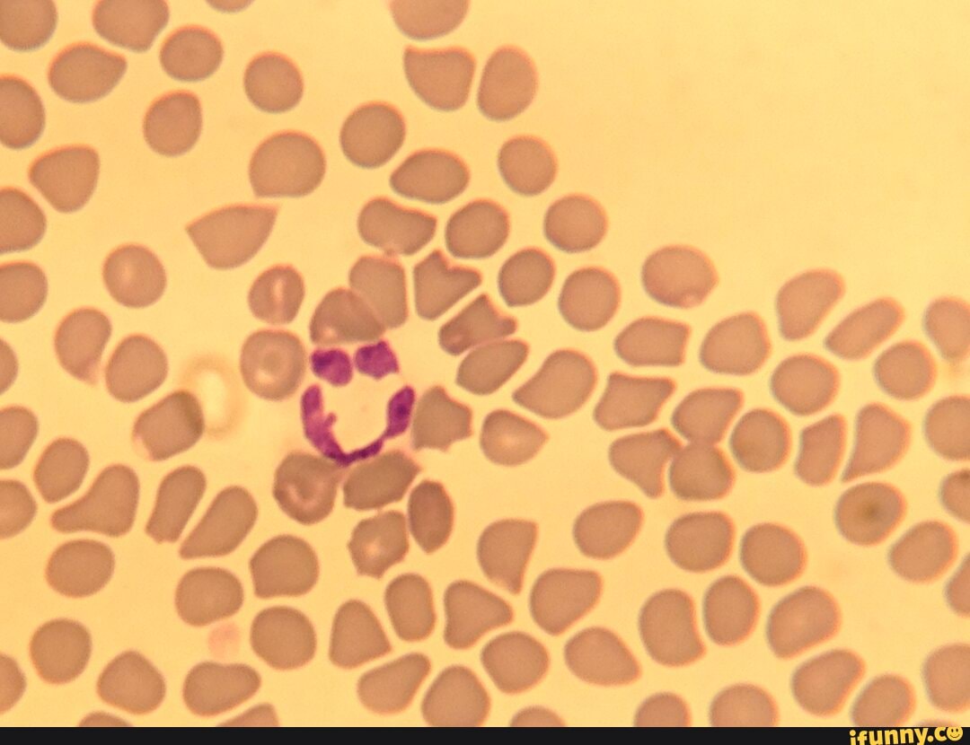 Hematology memes. Best Collection of funny Hematology pictures on iFunny