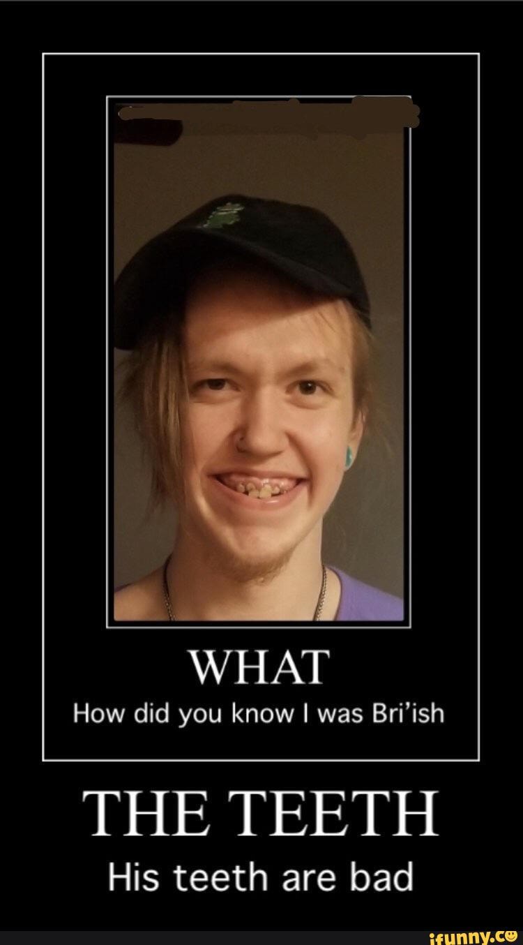 WHAT How did you know I was Bri'ish THE TEETH His teeth are bad - iFunny