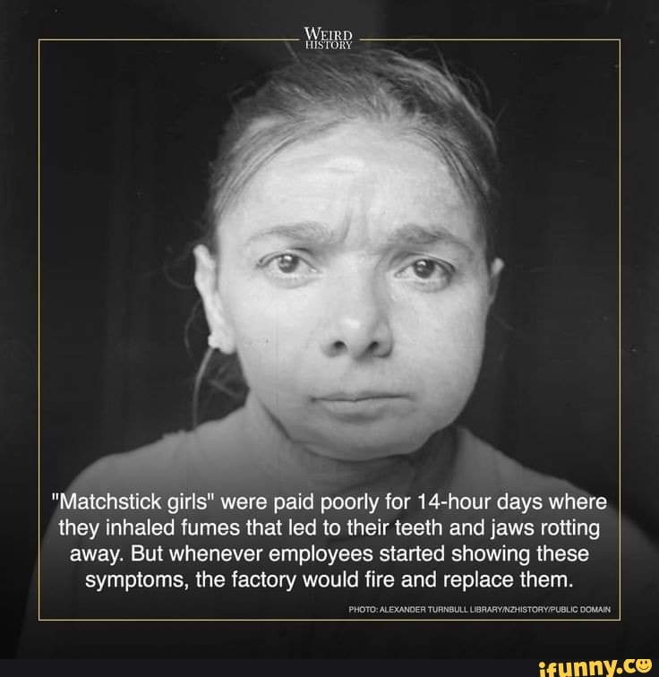 "Matchstick girls" were paid poorly for 14-hour days where they inhaled ...