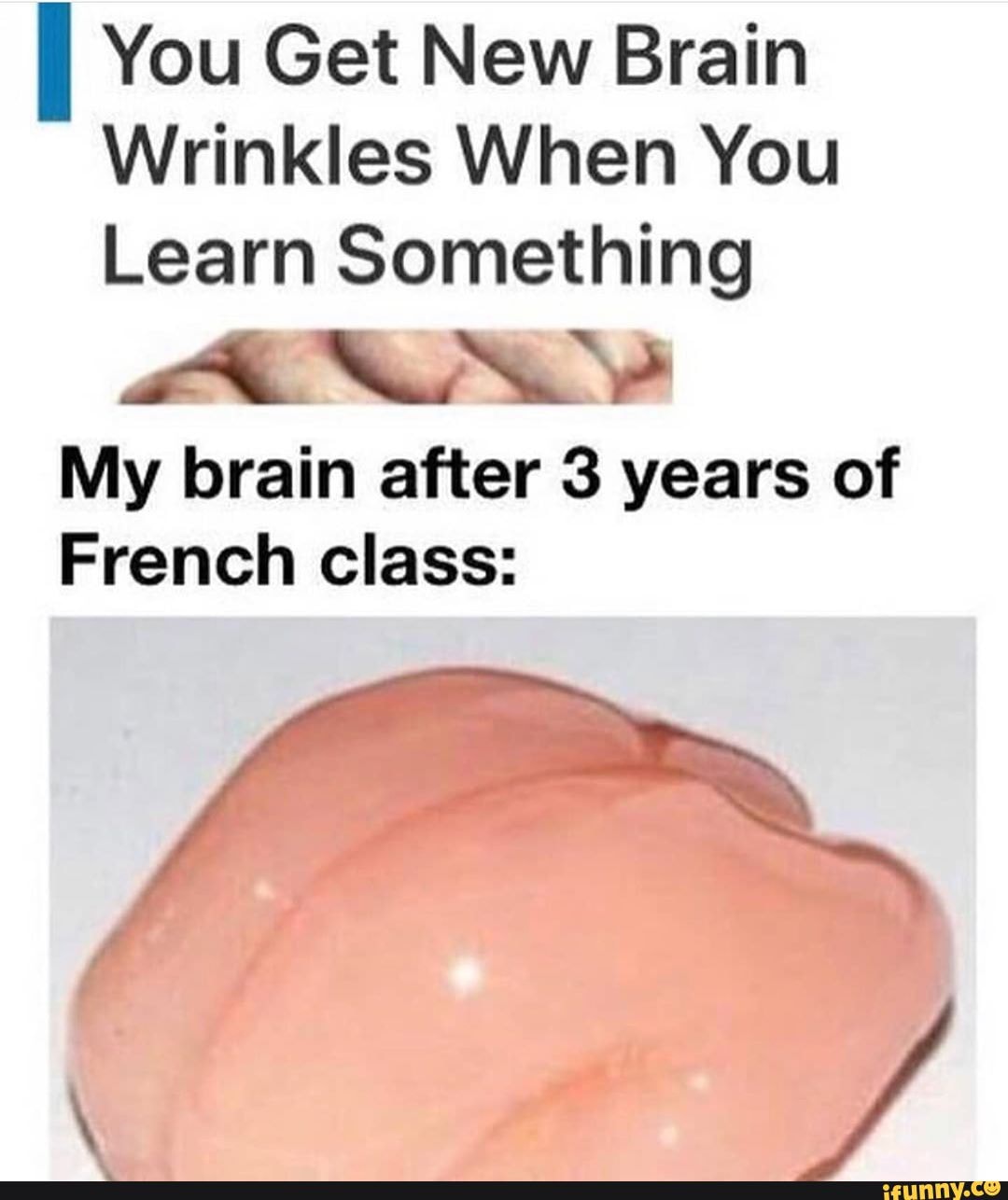 You Get New Brain Wrinkles When You Learn Something NY My brain after 3 ...