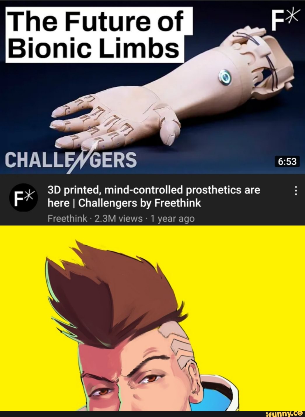 The Future of Bionic Limbs printed, mind-controlled prosthetics are ...