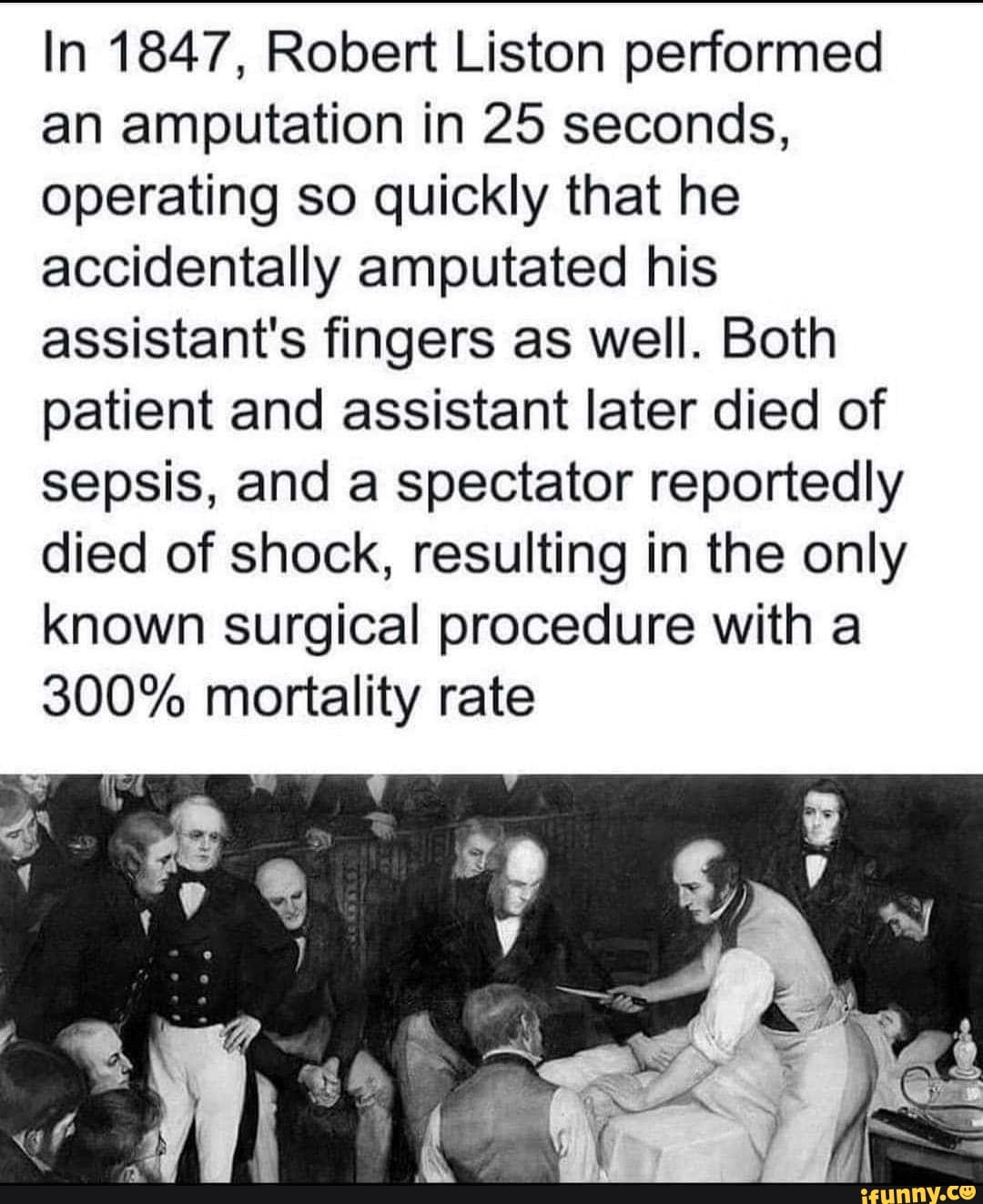 In 1847, Robert Liston performed an amputation in 25 seconds, operating ...