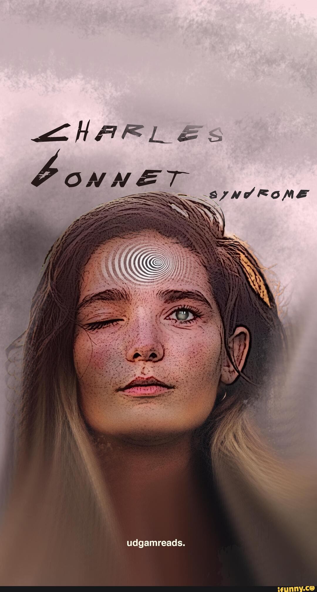 Does any of you know what Charles Bonnet Syndrome is? - ZHARL ES bonner ...