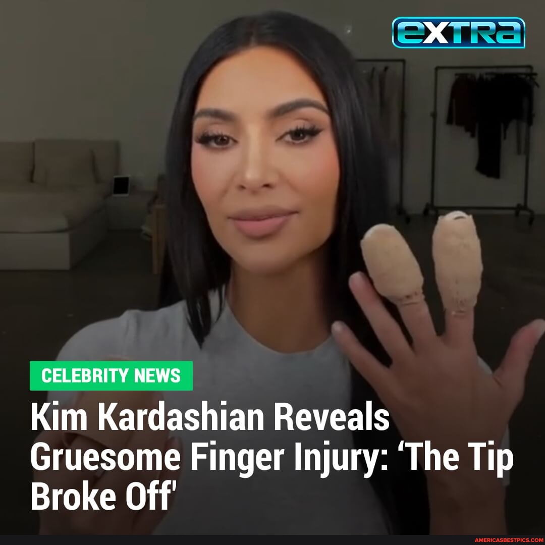 Kim Kardashian is sharing the details of a gruesome finger injury that ...