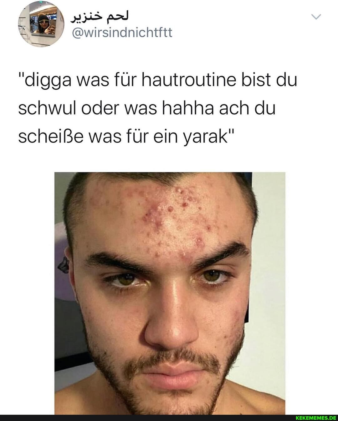 Yarak memes. Best Collection of funny Yarak pictures on Keke