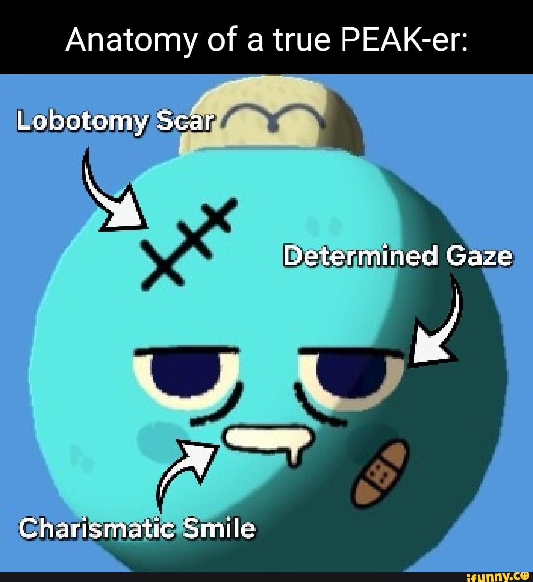 Anatomy of a true PEAK-er: Lobotomy Scar Determined Gaze Charismatic ...
