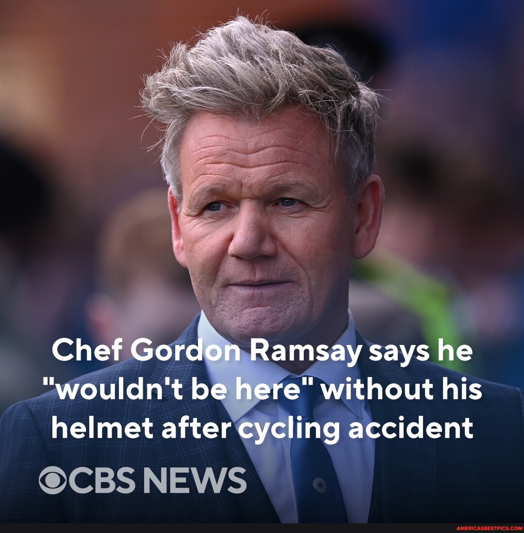 Celebrity chef Gordon Ramsay revealed an enormous bruise across his ...