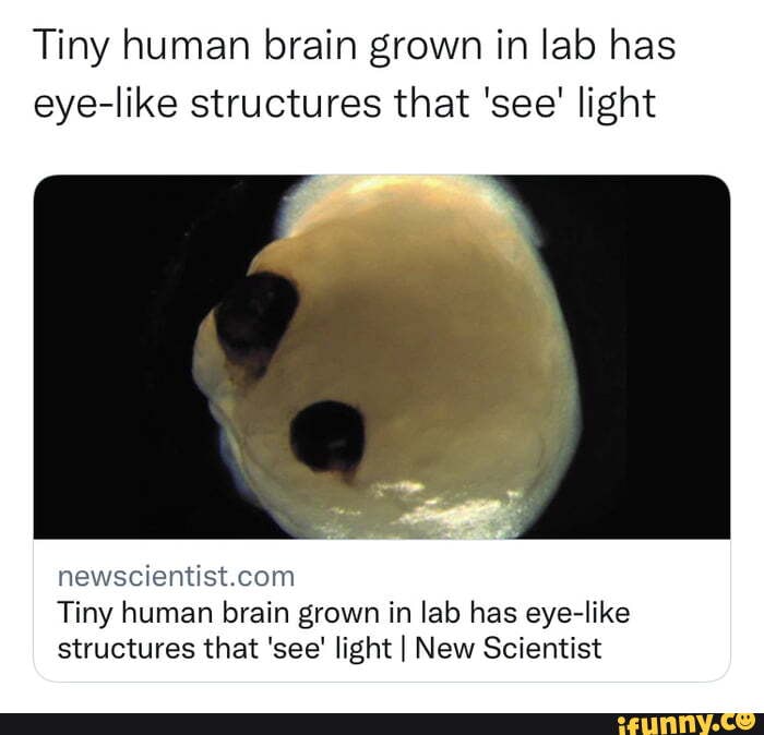 Tiny human brain grown in lab has eye-like structures that 'see' light ...
