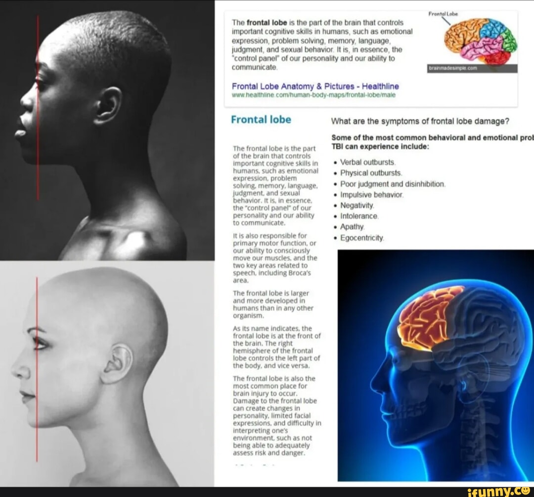 The frontal lobe is the part of the brain that controls important ...