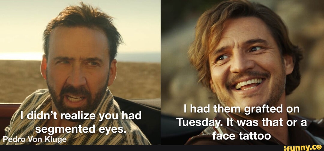 Had them grafted on Tuesday. It was that or a face tattoo I didn't ...