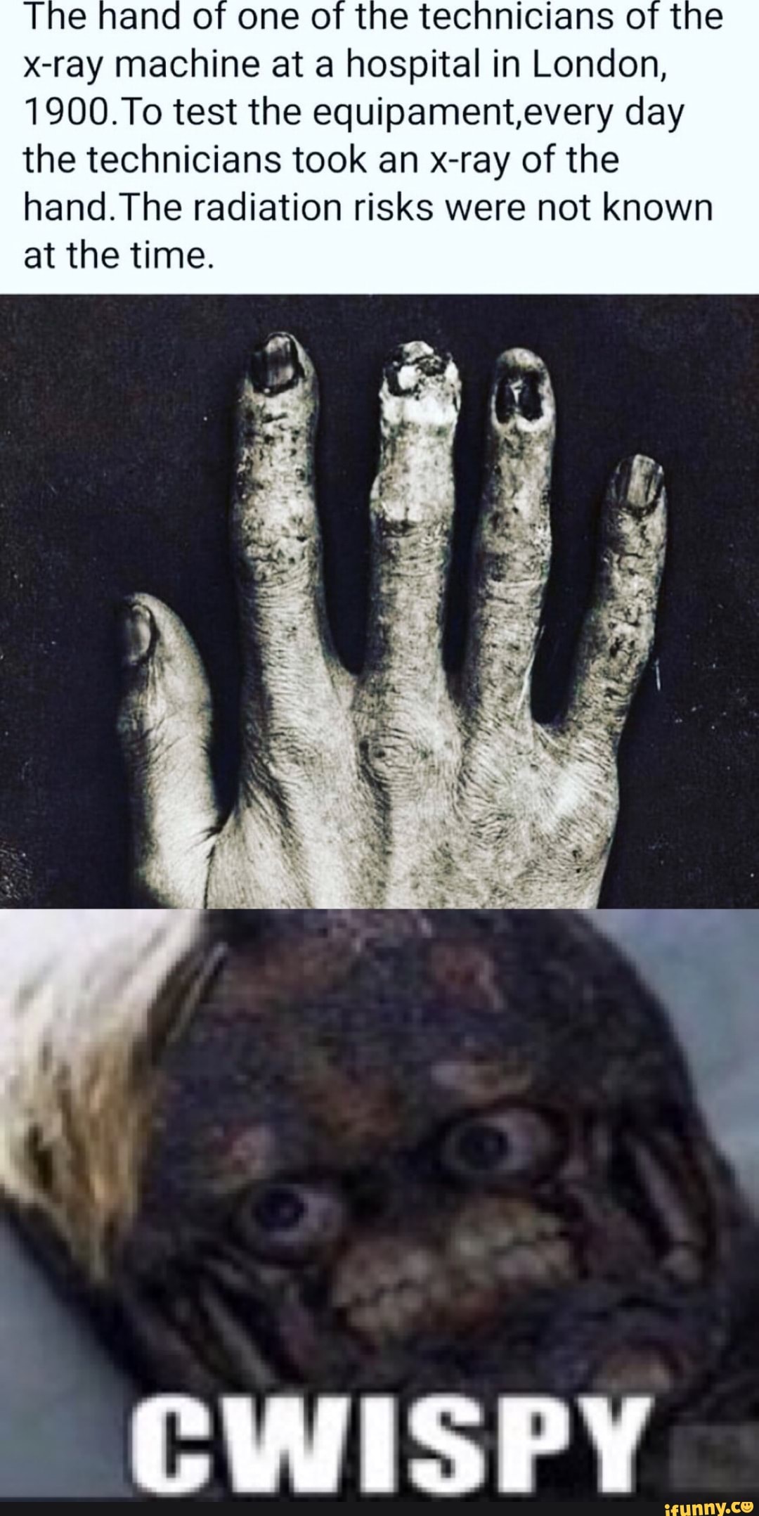 The hand of one of the tecnnicians of the x-ray machine at a hospital ...