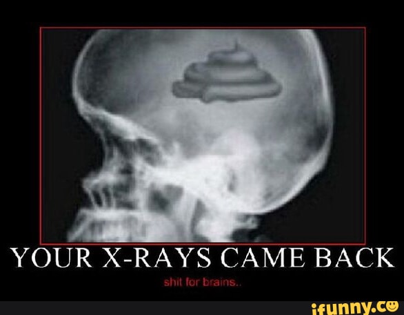 Xray memes. Best Collection of funny Xray pictures on iFunny