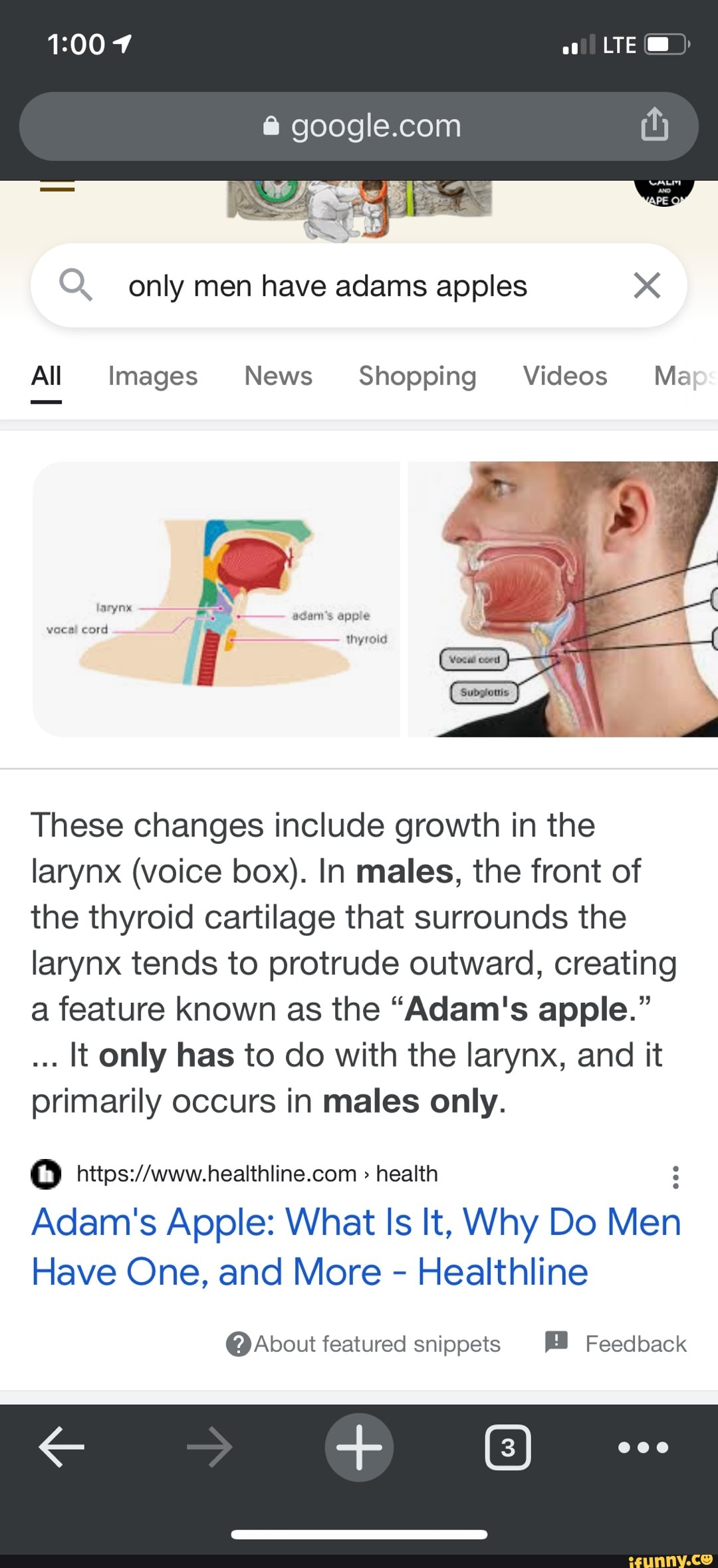 Q. only men have adams apples All Images News Shopping Videos Ma These ...