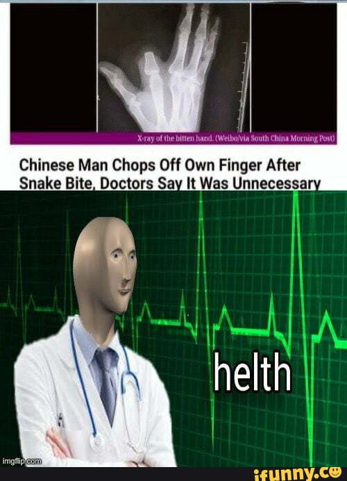 Chinese Man Chops Off Own Finger After Snake Bite, Doctors Say It Was ...