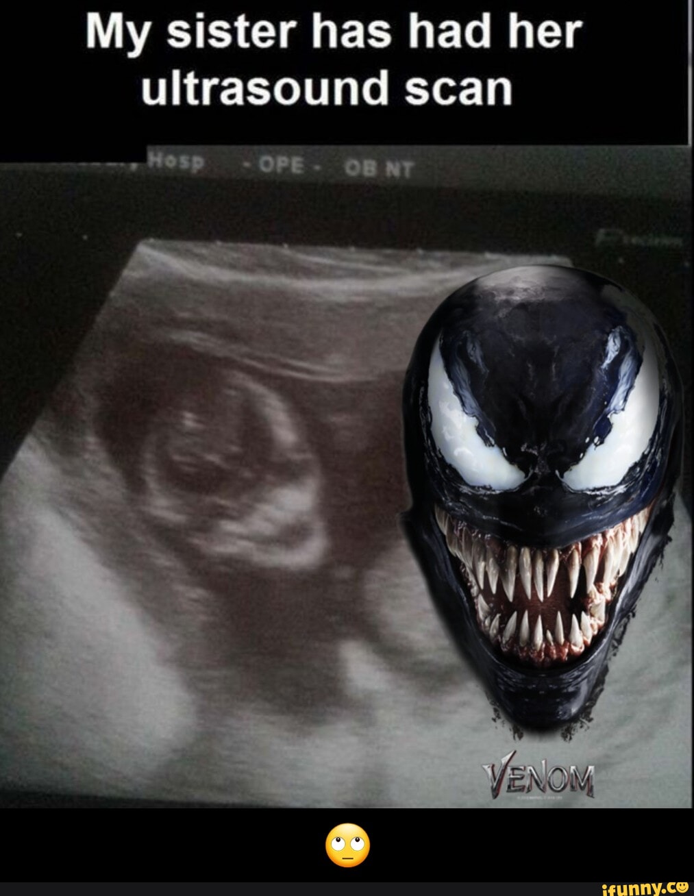 Ultrasound memes. Best Collection of funny Ultrasound pictures on iFunny
