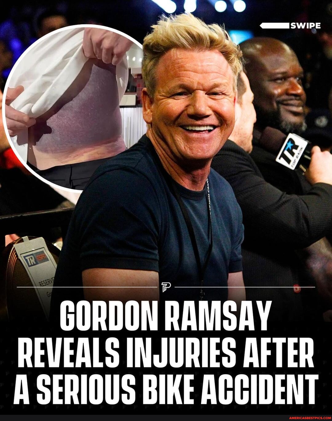 Celebrity chef Gordon Ramsay narrowly avoided a serious injury in a ...