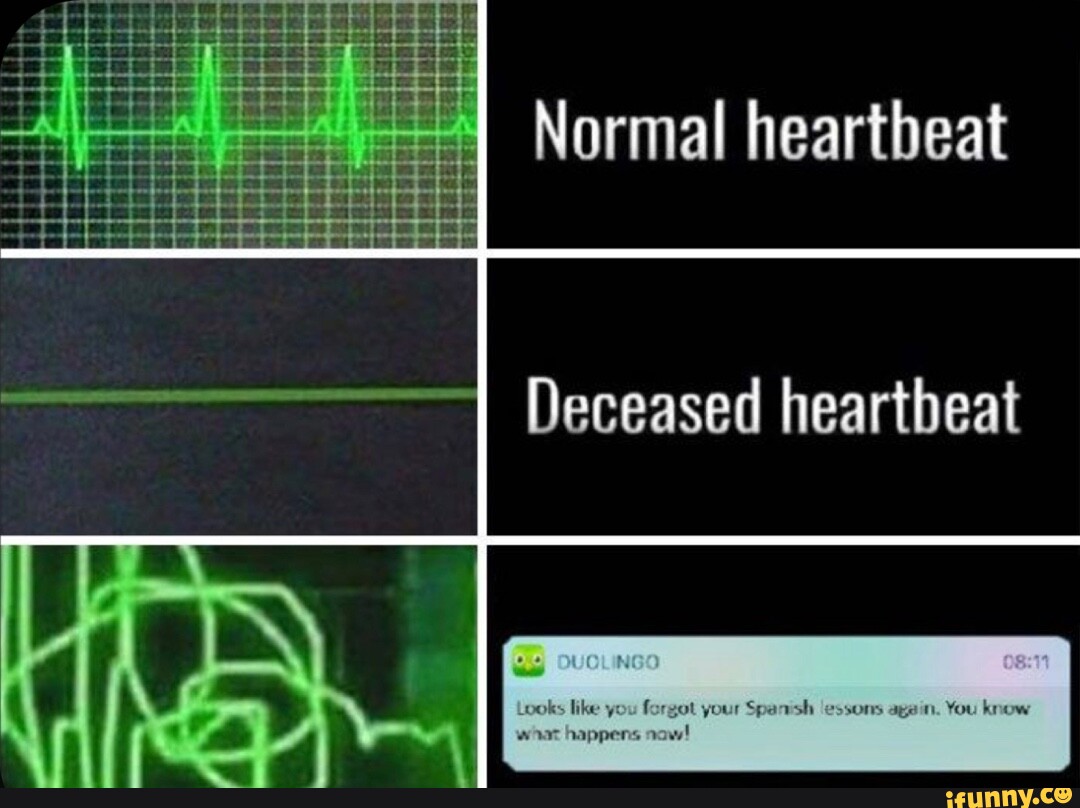 Normal heartbeat Deceased heartbeat - iFunny