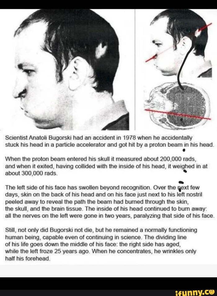 What happens when you get shot by a proton beam - Scientist Anatoli ...