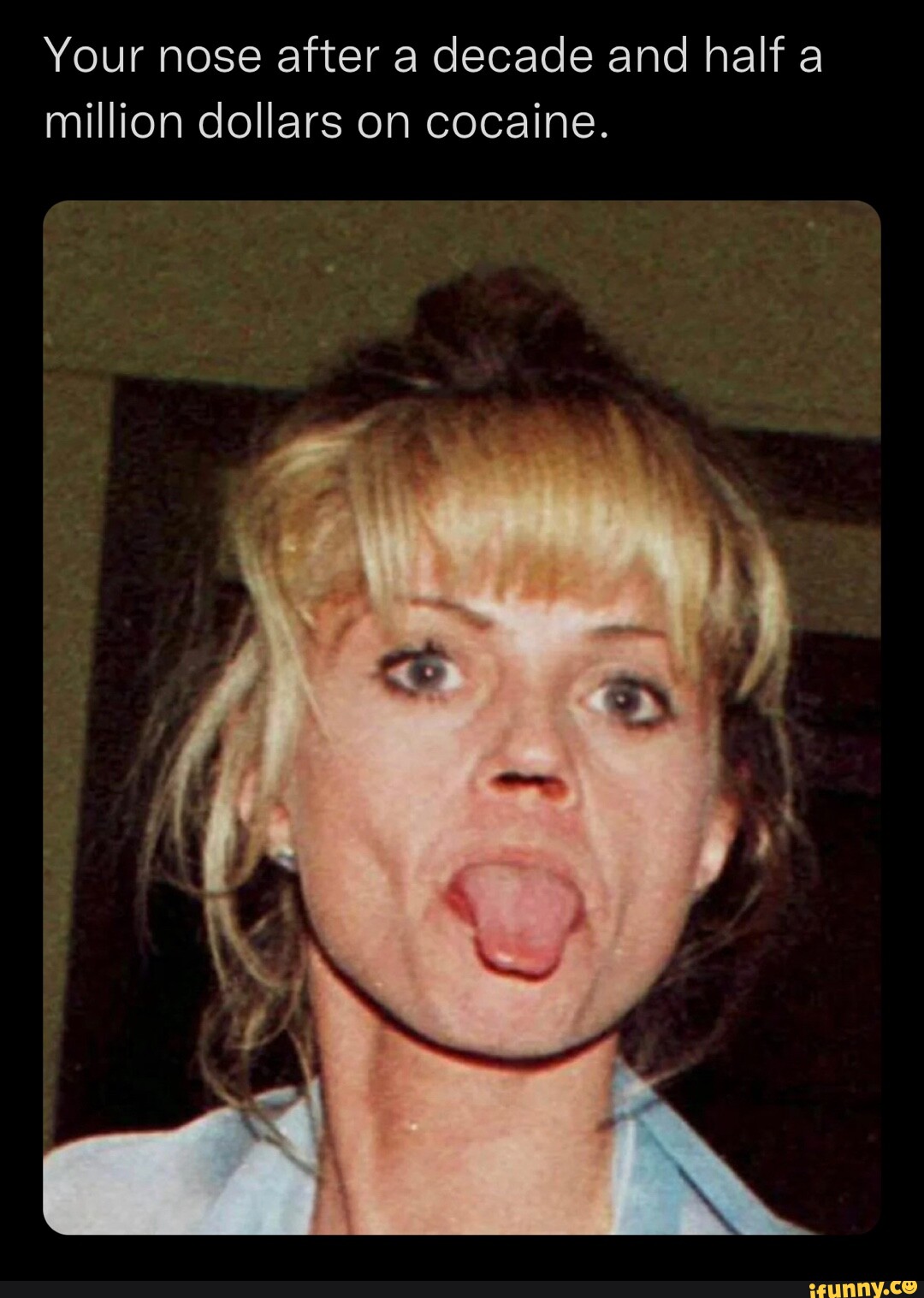 Your nose after a decade and half a million dollars on cocaine. - iFunny