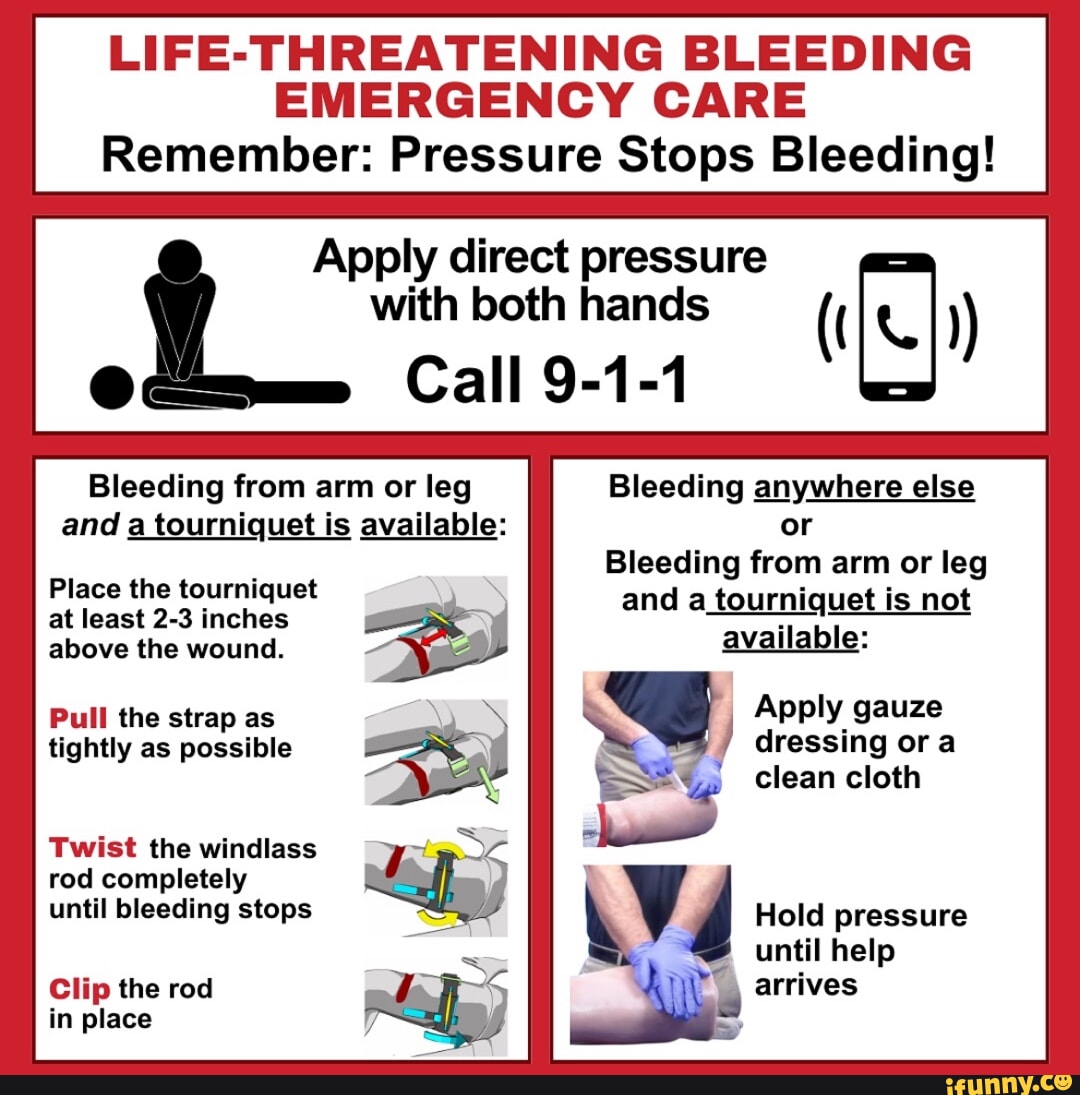 LIFE-THREATENING BLEEDING EMERGENCY CARE Remember: Pressure Stops ...