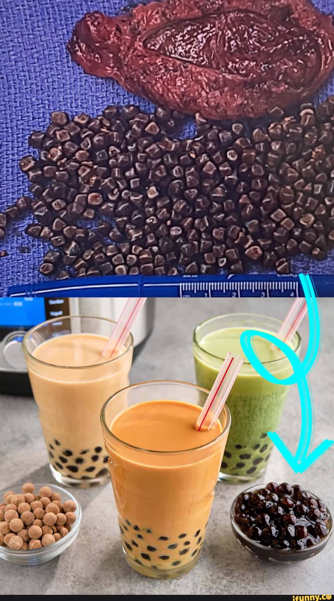 Gallstone memes. Best Collection of funny Gallstone pictures on iFunny