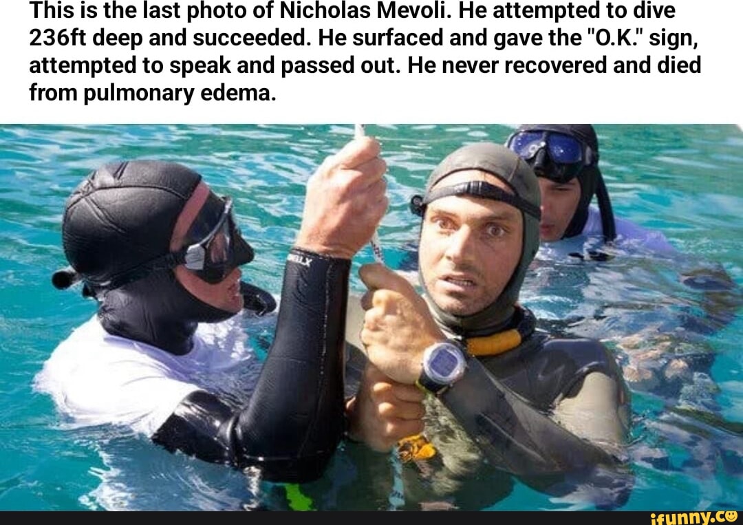 Edema memes. Best Collection of funny Edema pictures on iFunny