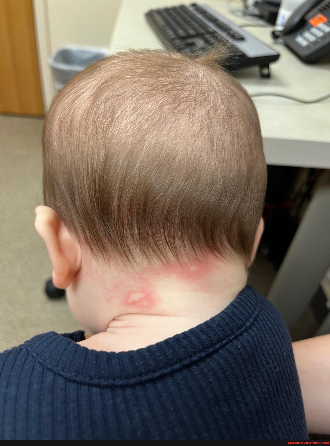 Son developed over night these rashes that pop up and then disappear ...