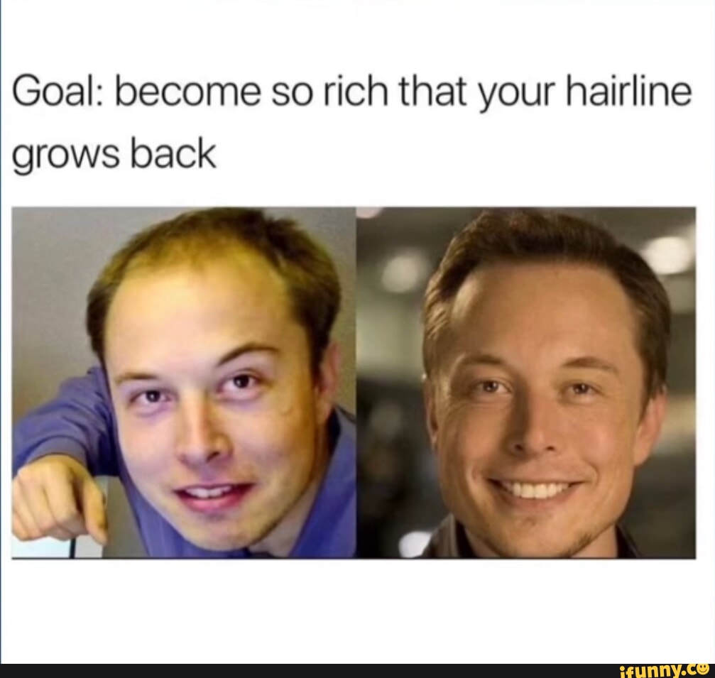 Hairline memes. Best Collection of funny Hairline pictures on iFunny