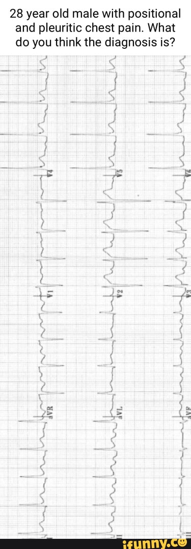 28 year old male with positional and pleuritic chest pain. What do you ...