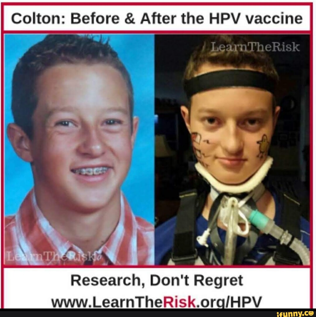 Hpv memes. Best Collection of funny Hpv pictures on iFunny