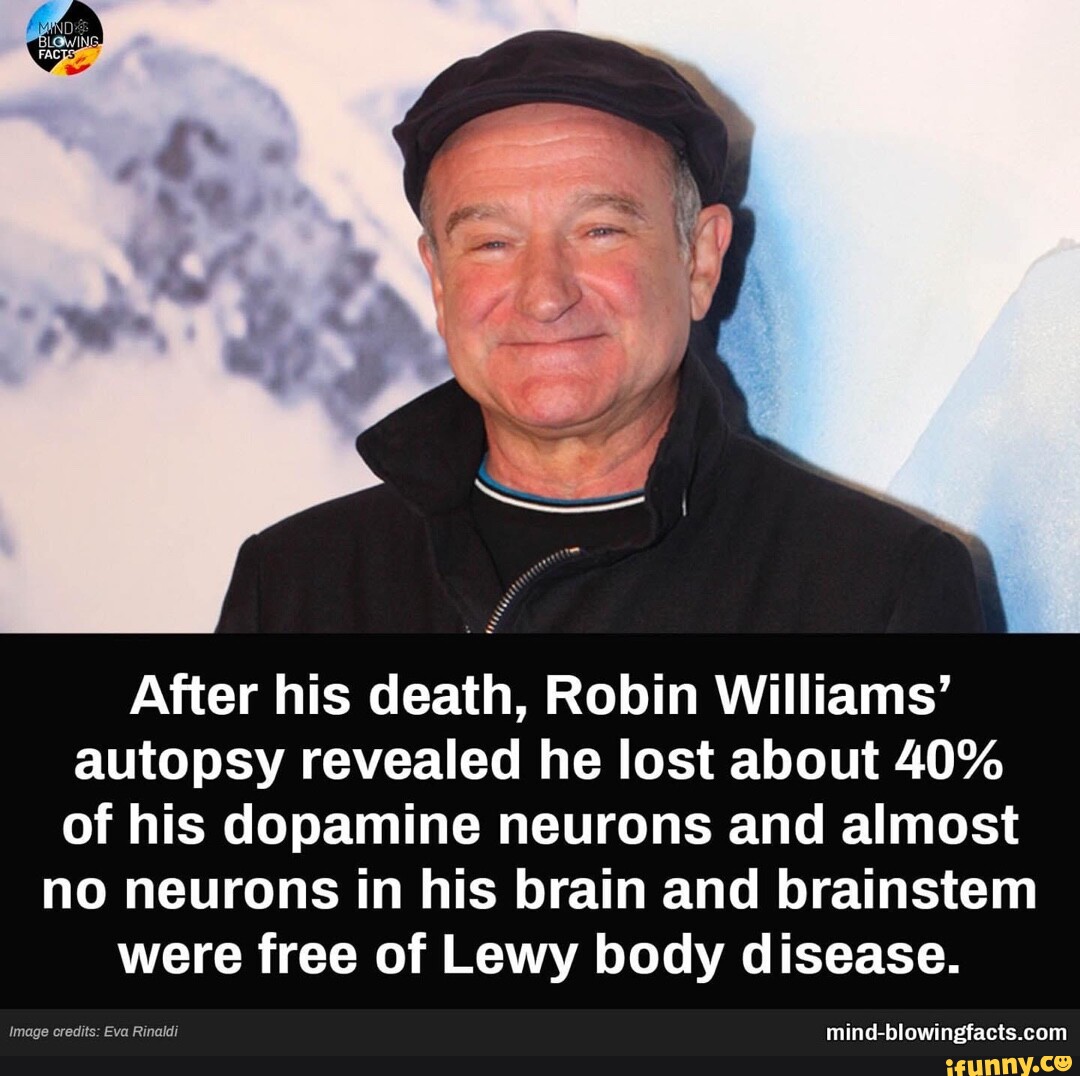 After his death, Robin Williams' autopsy revealed he lost about 40% of ...