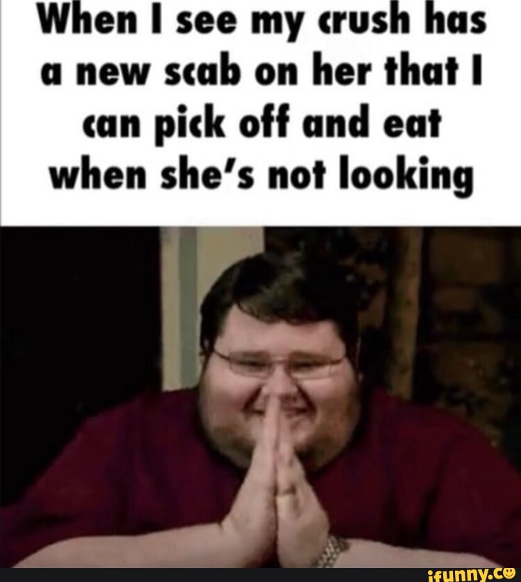 When I see my crus a new scab on her that I can pick off and eat when ...