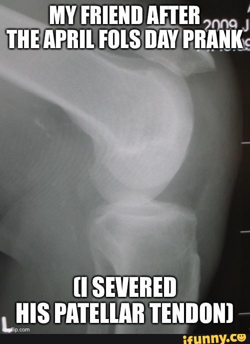 Patellar memes. Best Collection of funny Patellar pictures on iFunny