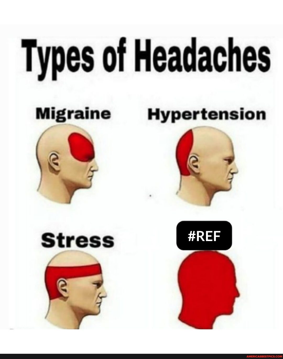 #True #investmentbanking #excel #memes #financememes - Types of ...
