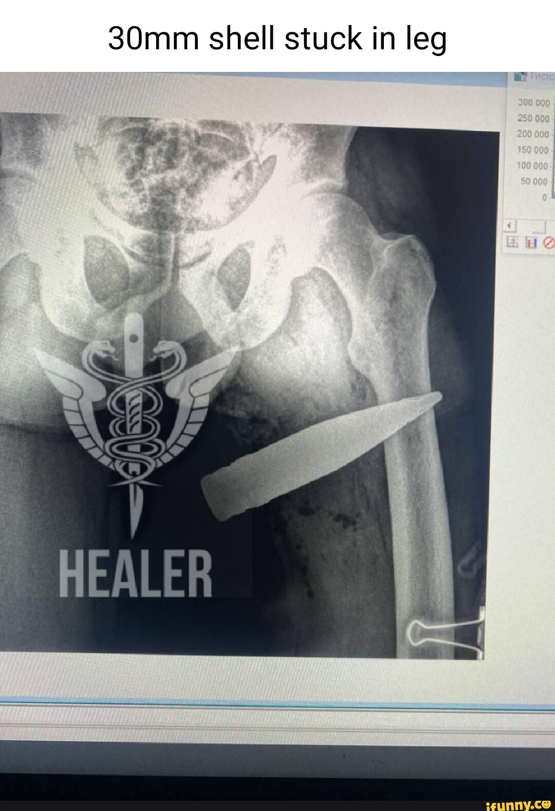 Stuck memes. Best Collection of funny Stuck pictures on iFunny