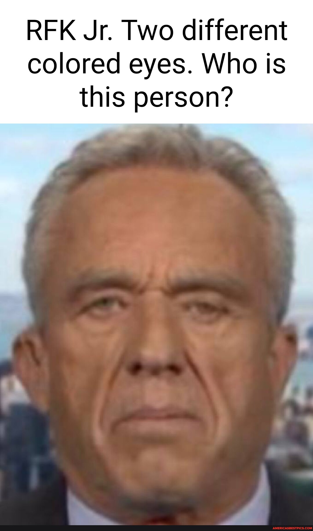 RFK Jr. Two different colored eyes. Who is this person? - America’s ...