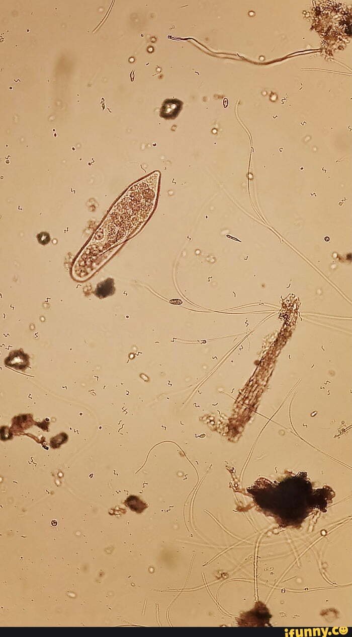 Paramecium memes. Best Collection of funny Paramecium pictures on iFunny