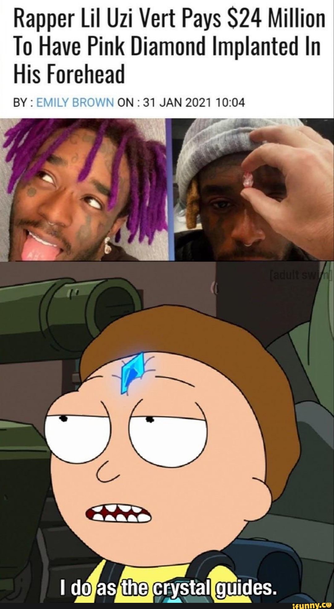 Rapper Lil Uzi Vert Pays $24 Million To Have Pink Diamond Implanted In ...