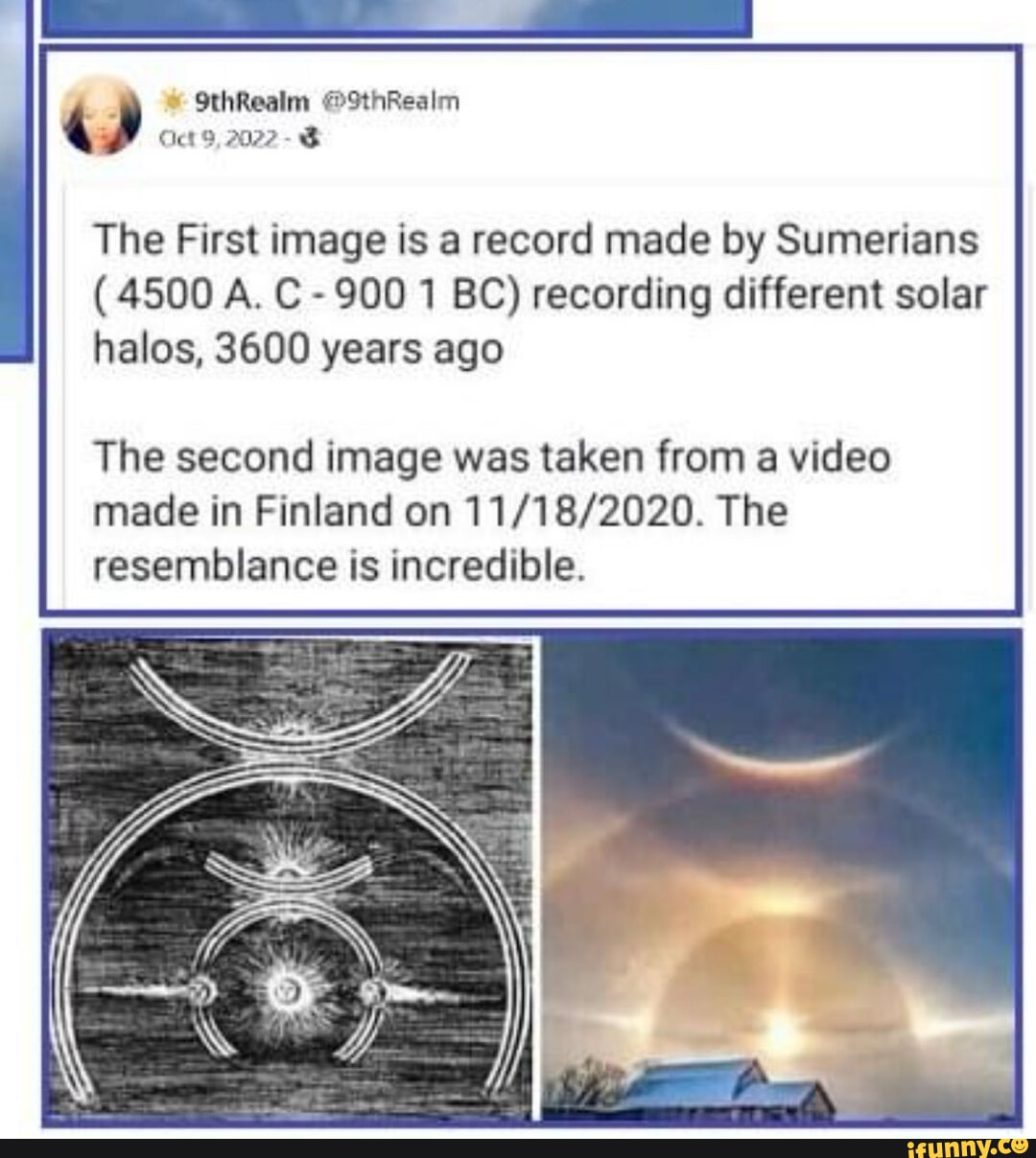 Japanese gymnast, Shun Fujimoto, once broke his knee at the Olympics in ...