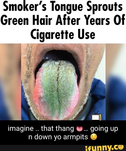 Smoker's Tongue Sprouts Green Hair After Years Of Cigarette Use imagine ...