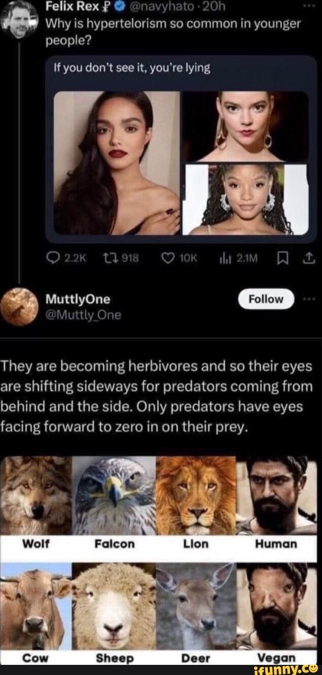 Felix Rex @ navyhato Why is hypertelorism so common in younger people ...